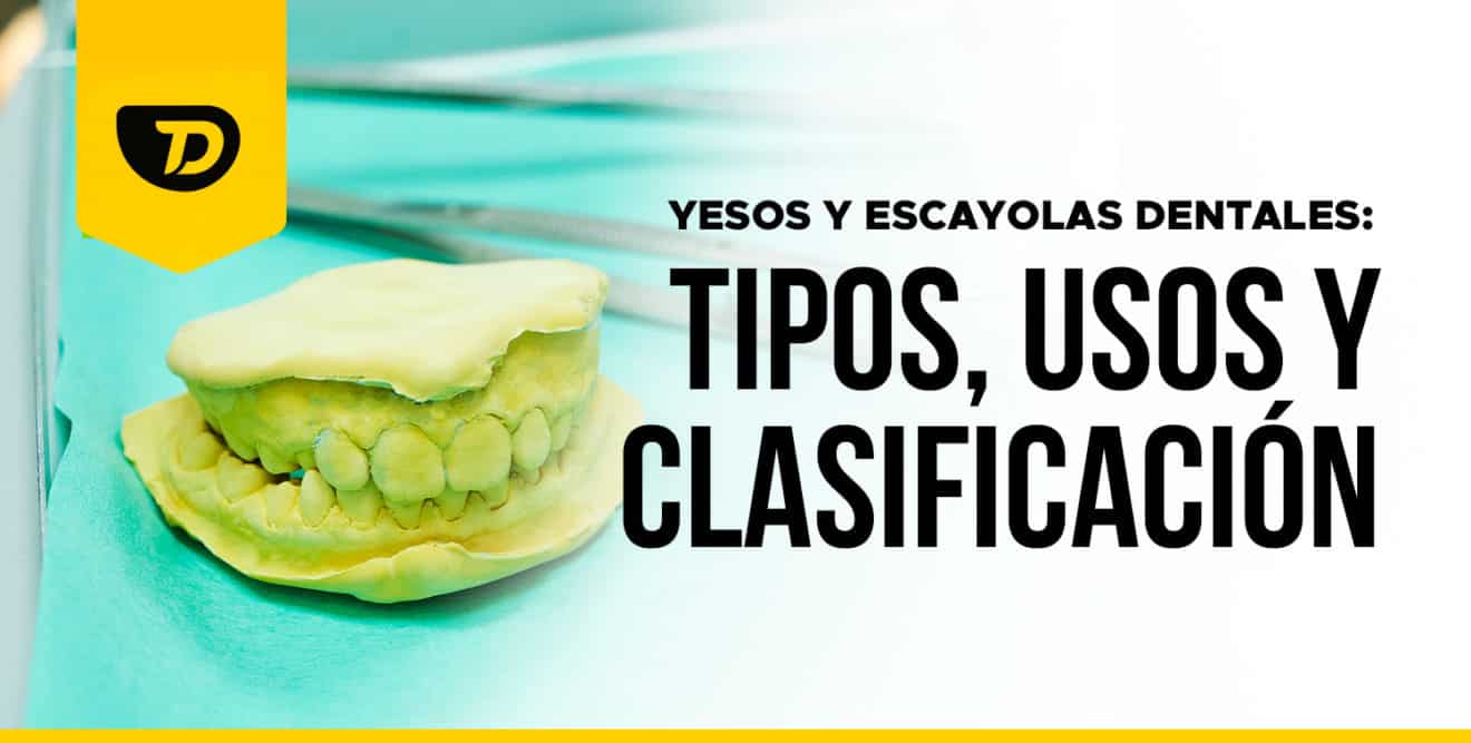 Yesos y Escayolas Dentales: Tipos, usos y clasificación | Techdent