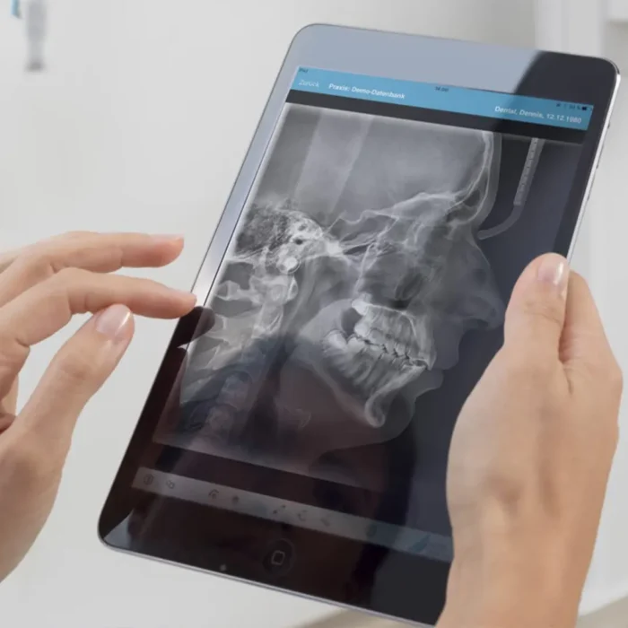 VistaVox S Ceph - Equipo Extraoral 3 en 1 (3d-2d) Durr Dental | Techdent