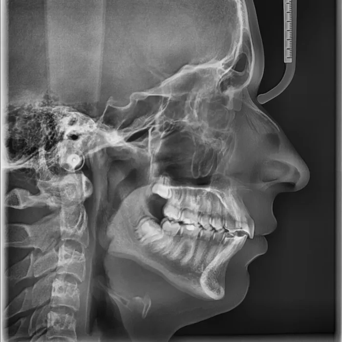 VistaVox S Ceph - Equipo Extraoral 3 en 1 (3d-2d) Durr Dental | Techdent